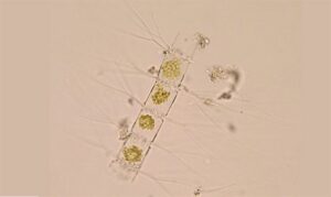 Bacteriastrum shadbolt - Marine Biodiversity Portal of Bangladesh