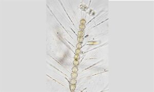 Phytoplankton - Marine Biodiversity Portal of Bangladesh