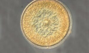 Coscinodiscus argus - Marine Biodiversity Portal of Bangladesh