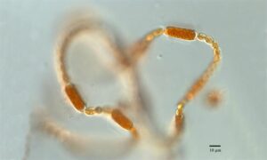 Dolichospermum sigmoideum - Marine Biodiversity Portal of Bangladesh