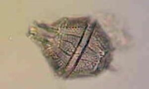 Gonyaulax polygramma - Marine Biodiversity Portal of Bangladesh