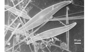 Gyrosigma acuminatum - Marine Biodiversity Portal of Bangladesh