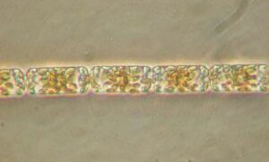 Leptocylindrus danicus - Marine Biodiversity Portal of Bangladesh