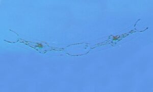 Neomoelleria cornuta - Marine Biodiversity Portal of Bangladesh