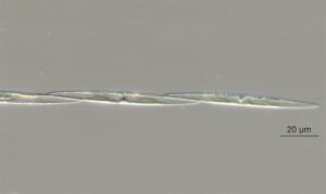 Phytoplankton - Marine Biodiversity Portal of Bangladesh