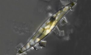 Pleurosigma angulatum - Marine Biodiversity Portal of Bangladesh