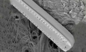 Thalassiothrix longissima - Marine Biodiversity Portal of Bangladesh