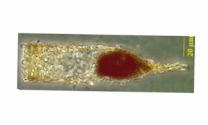 Tintinnopsis radix - Marine Biodiversity Portal of Bangladesh