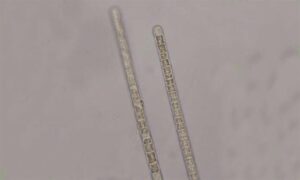 Trichodesmium erythraeum - Marine Biodiversity Portal of Bangladesh