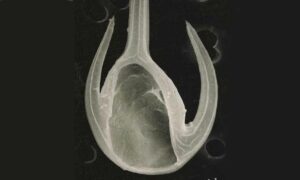 Tripos azoricus - Marine Biodiversity Portal of Bangladesh